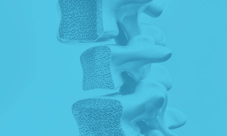 Osteoporosis Related Spinal Fracture | Southern Illinois Healthcare
